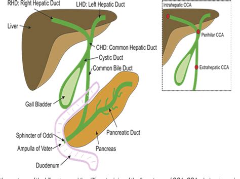 Figure 1 From Ablative Therapy For Unresectable Intrahepatic