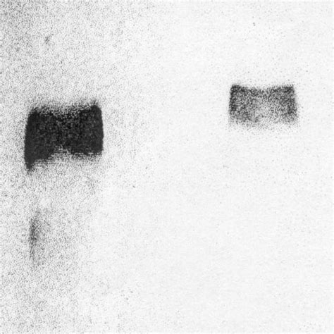 Western Blot Immunoassay For Proteinbond Carbonyl Groups In Pure