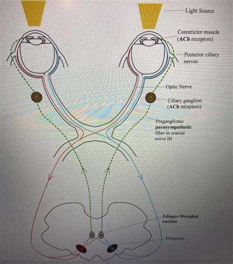 Solved Ivc Pupillary Light Reflex Arc List The