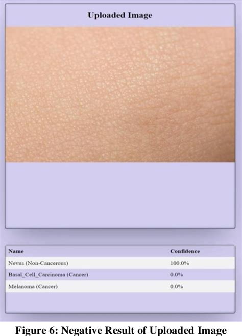 Figure 6 From Skin Cancer Detection Using Deep Learning Semantic Scholar