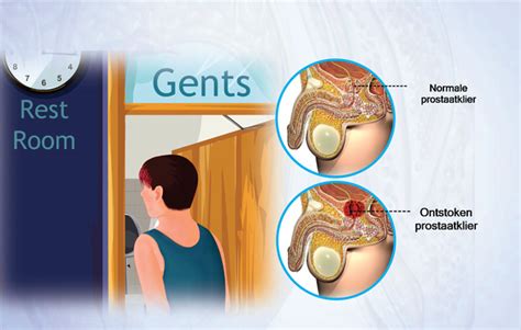 Health Condition Symptoms Causes Treatment And More