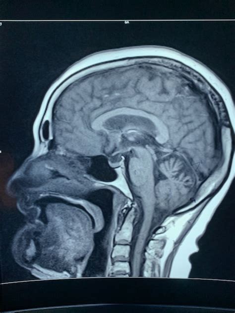 Sagittal Mri Diagram Quizlet