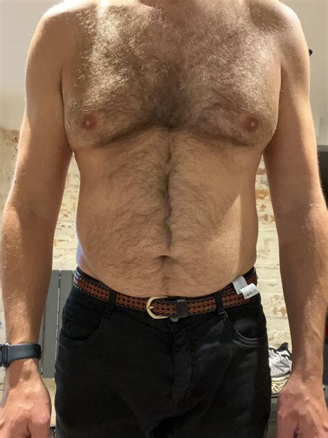 3 Month Progress Report Dr Nurein Still A Long Way To Go But Can Really Notice The Difference