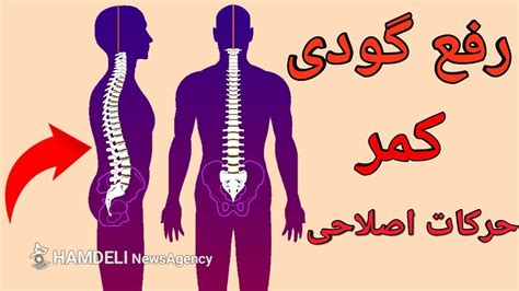 درمان گودی کمر حرکات اصلاحی همدلی زنجان