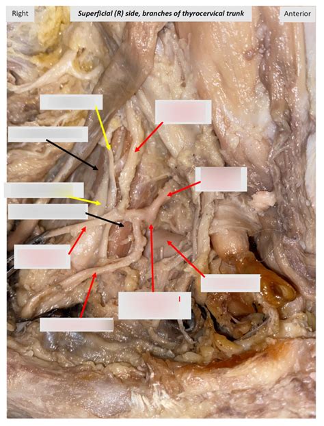 Gross Lab 2 Superficial Thyrocervical Trunk Diagram Quizlet