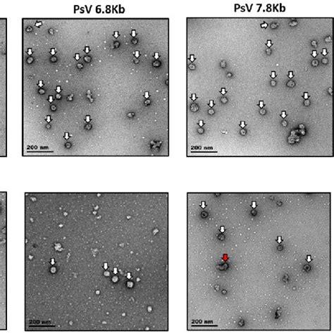 confirmation of particle assembly representative transmission electron