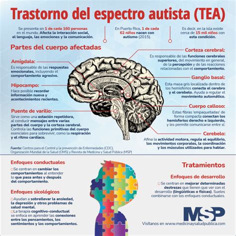 Qué es el trastorno del espectro autista MiBBmemima