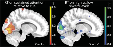 Effects Of Genetic Variability Of Cyp2d6 On Neural Substrates Of