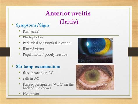 Dr Amani Badawi Assistant Professor Ophthalmology Ppt Video Online