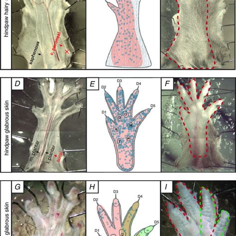 Innervation Areas Of The Saphenous Tibial And Medianulnar Nerves