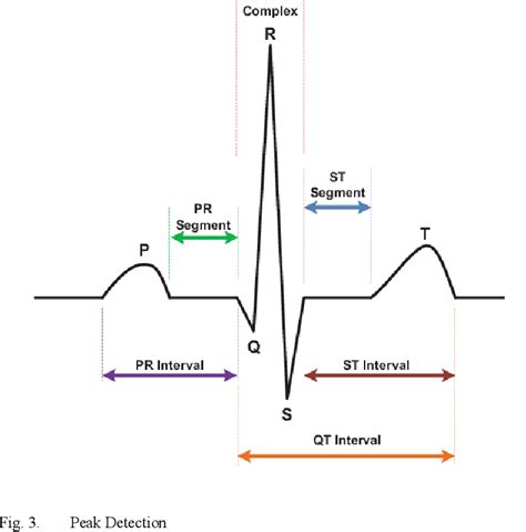 Figure From Anomaly Detection In Cardiac Related Datasets Semantic Scholar