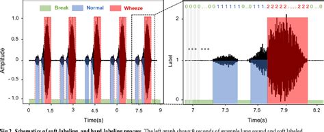 Figure 2 From Real Time Counting Of Wheezing Events From Lung Sounds