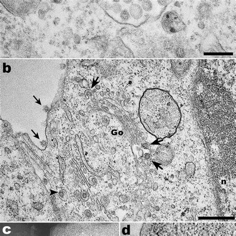 Transmission Electron Microscopy Of Sars Cov 2 Variant Rj1 Pre Egress