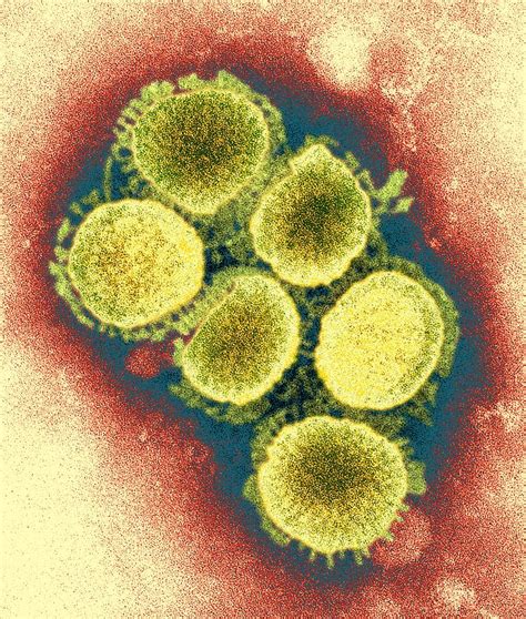 H1n1 Swine Flu Virus