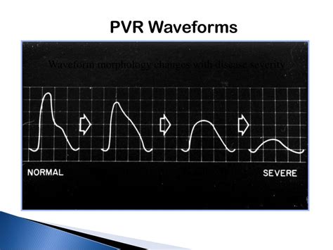 Arterial Physiologic Testing Lower Extremities Ppt Download