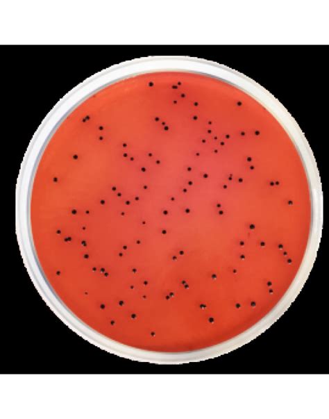 Km0013 Xylose Lysine Desoxycholate Agar Xld E O Salmonella On Xld Agar