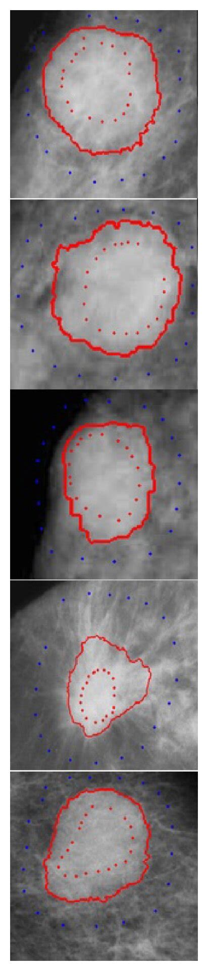 The Comparison With Other Interactive Segmentation Methods Download