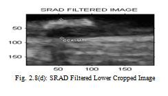 Measurement Of Lower And Upper IMT From Ultrasound Video Frames Biomedical And Pharmacology