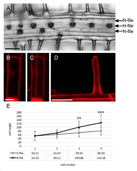 Root Hair Development In Arabis Alpina A Light Microscope Picture