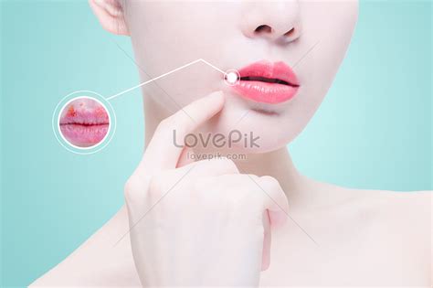 겨울 입술이 트다 배경 사진 및 창의적인 일러스트 무료 다운로드 Lovepik