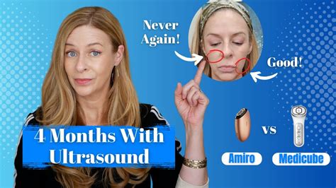 Ultrasound Showdown Amiro U1 Vs Medicube Deep Shot The Good And Bad Youtube