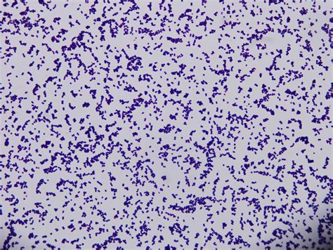Staphylococcus Pseudintermedius Colonies Gram Stain Of Sta… Flickr