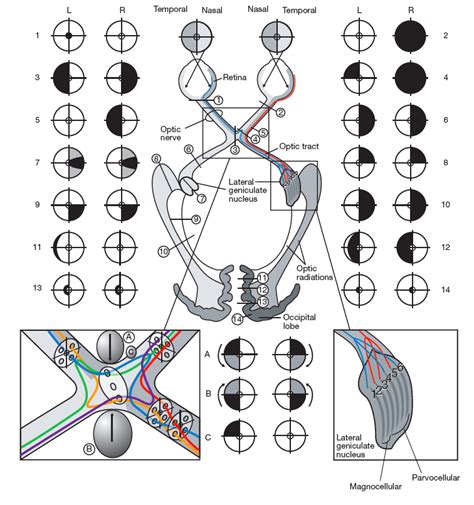 Visual Field Lesions Optometry Optometry Education Anatomy And