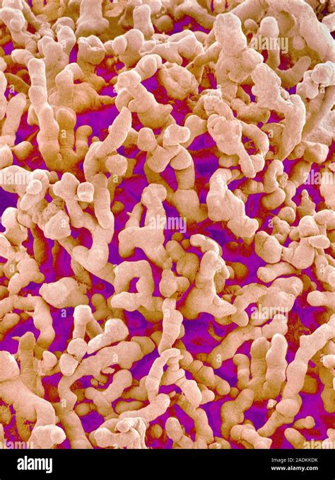 Human Placenta Coloured Scanning Electron Micrograph Sem Of Villi In