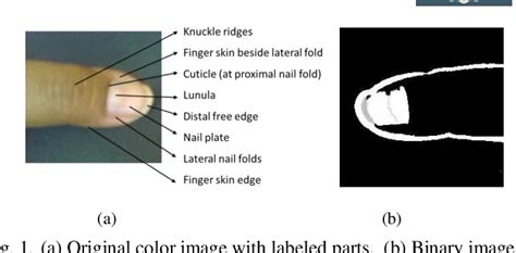 Figure 1 From Fingernail Biometric For Efficient Person Identification Semantic Scholar