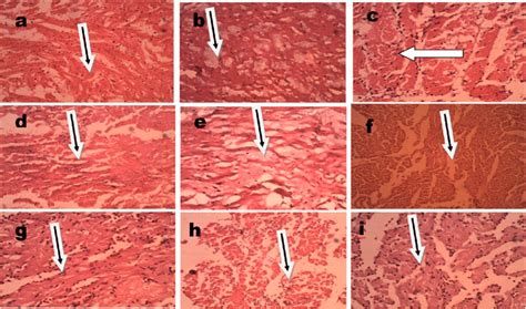 Photomicrograph Of The Gills Normal Aspect Of The Gills Filament A