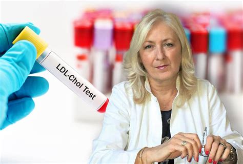 Kada Treba Uraditi Prvi Skrining Test Za LDL Holesterol Zdravlje Kurir