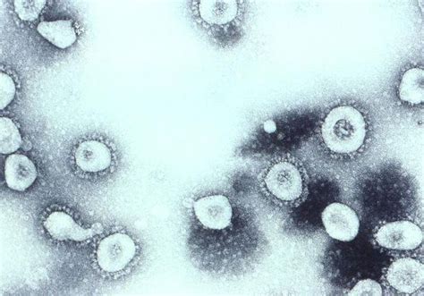 Cold Virus Microscope