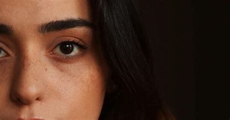 Recite zbogom flekama na koži Domaći serum od sastojka uklanja tamne mrlje sa vašeg lica