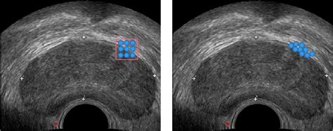 Figure 3 From Prostate Ultrasound Image Segmentation Based On Dsu Net