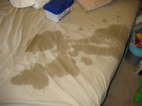 Enuresis Bed Wetting Homeopathic Treatment
