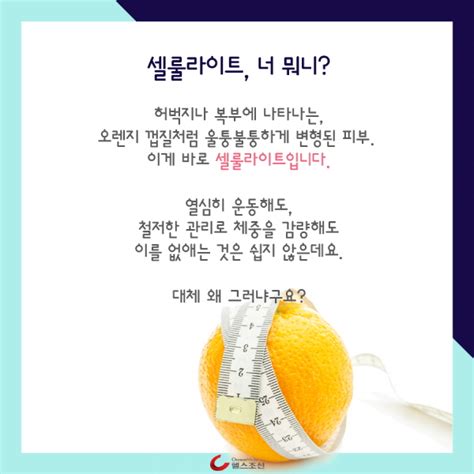 카드뉴스 셀룰라이트 알아야 빠진다 당신의 건강가이드 헬스조선