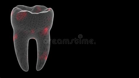 3d Tooth Scan Tooth Scanning Interface Hud Tooth Analyze Medical Science Anatomy Concept