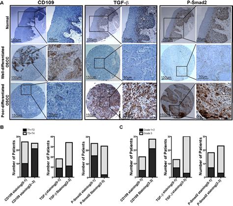 Cd109 Expression Inversely Correlates With Tgf β Smad Signalling Tumor Download Scientific