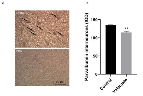 The Effect Of Prenatal Exposure To Valproate On Pv Positive Interneuron