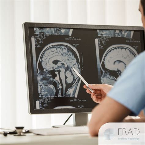 Erad Eradradiology Leadingradiology Radiology Brainscans Neuroimagingscans