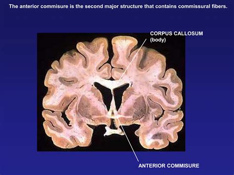 Physiology Of Cerebral Cortex Cerbral Cortex Ppt