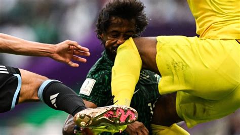 Fuerte choque Defensa de Arabia Saudita sufrió fracturas en su rostro