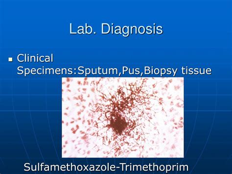 Ppt Actinomyces And Nocardia Powerpoint Presentation Free Download