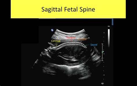 Ob Gyn Ultrasound Registry Review