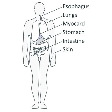 Organs Commonly Affected By Diffuse Cutaneous SSc Download Scientific Diagram