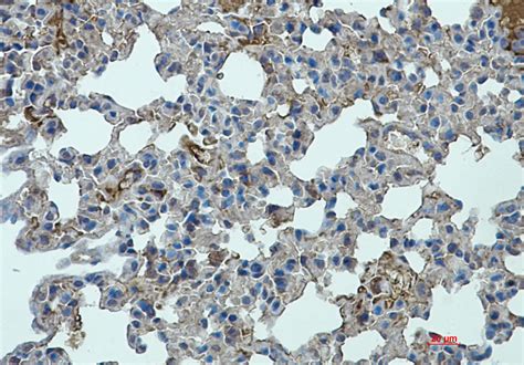 STAT2 Rabbit MAb WB IHC P Buy Now