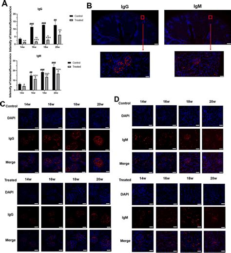 125 Dihydroxyvitamin D3 Decreased Deposition Of Iggm In Mrllpr Mice