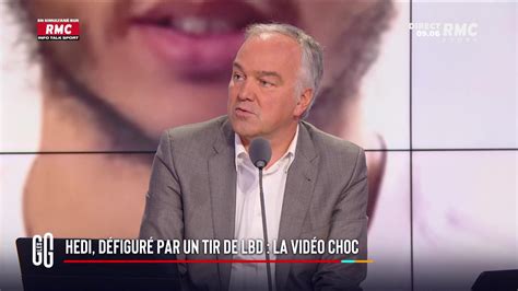 Replay Hedi Défiguré Par Un Tir De Lbd La Vidéo Choc Voir L