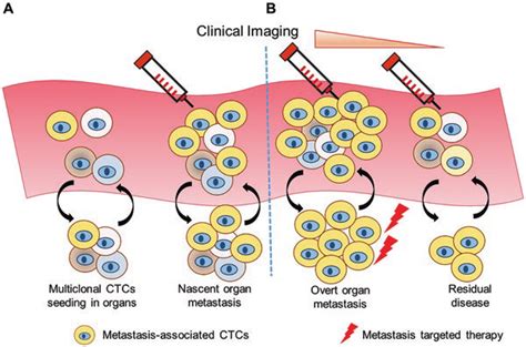 Translational Perspectives Employing Ctc Testing In Metastatic Cancer