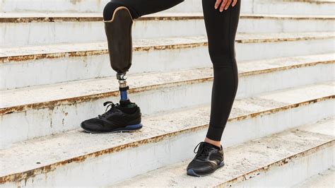 Scheduled Surgery During Daytime Improves Outcomes Of Lower Extremity